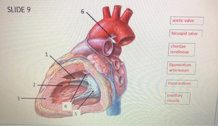 Solved SLIDE 6 left circumflex artery left marginal artery | Chegg.com