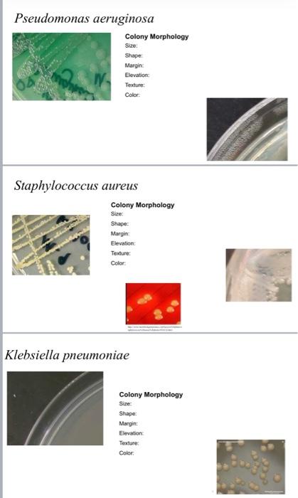 Bacillus subtilis Colony Morphology Size: Shape: | Chegg.com