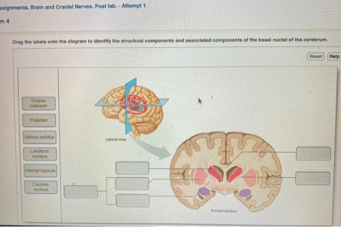 Solved ssignments. Brain and Cranial Nerves. Post lab. - | Chegg.com