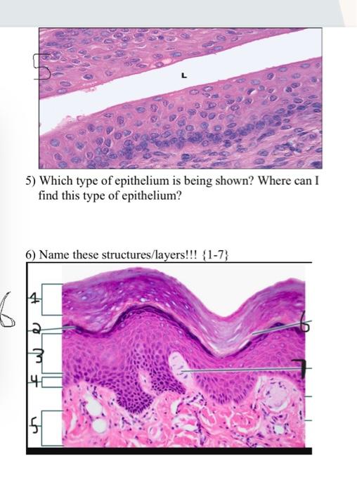 5) Which type of epithelium is being shown? Where can | Chegg.com