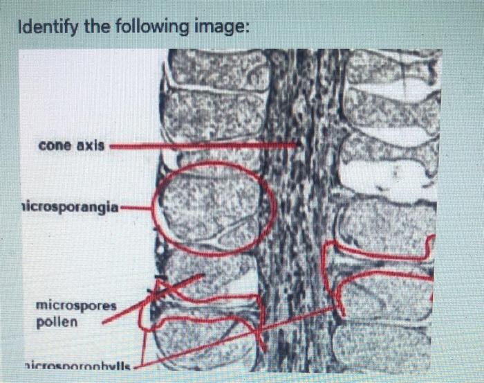 Solved Identify the following image: micropyle integument | Chegg.com
