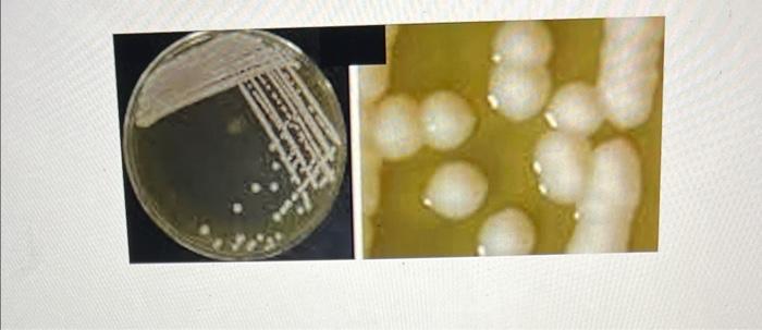 Solved Whats the pigment? -negative -yellow - redWhats the | Chegg.com