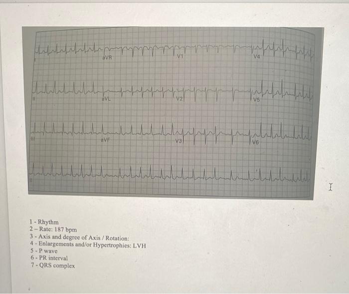 3. الالالا VR Vi VA mooh DI VL V5 M VF V3 VG 1 - | Chegg.com