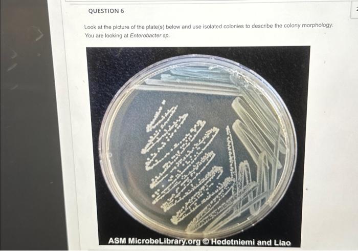 Solved Look at the picture of the plate(s) below and use | Chegg.com