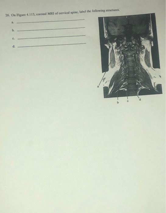 Solved 26. On Figure 4.113, coronal MRI of cervical spine, | Chegg.com