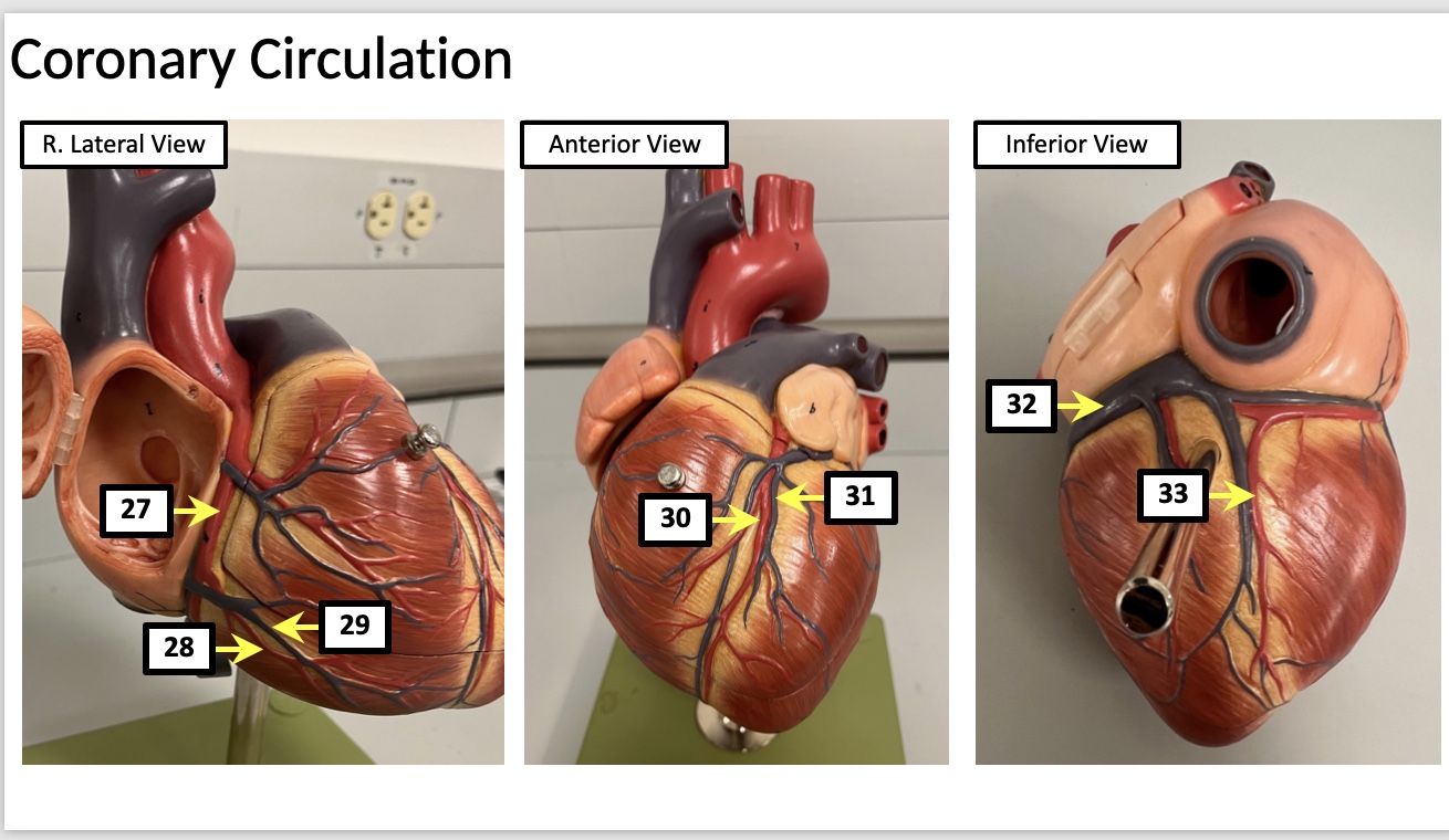 Solved coronary circulation identification right later view | Chegg.com