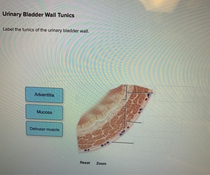 Solved Urinary Bladder Wall Tunics Label the tunics of the | Chegg.com