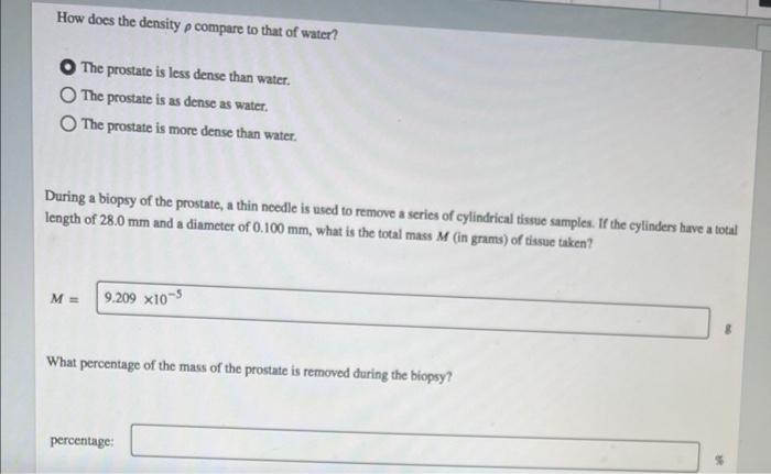 Solved A typical prostate gland has a mass of about 22 g and | Chegg.com