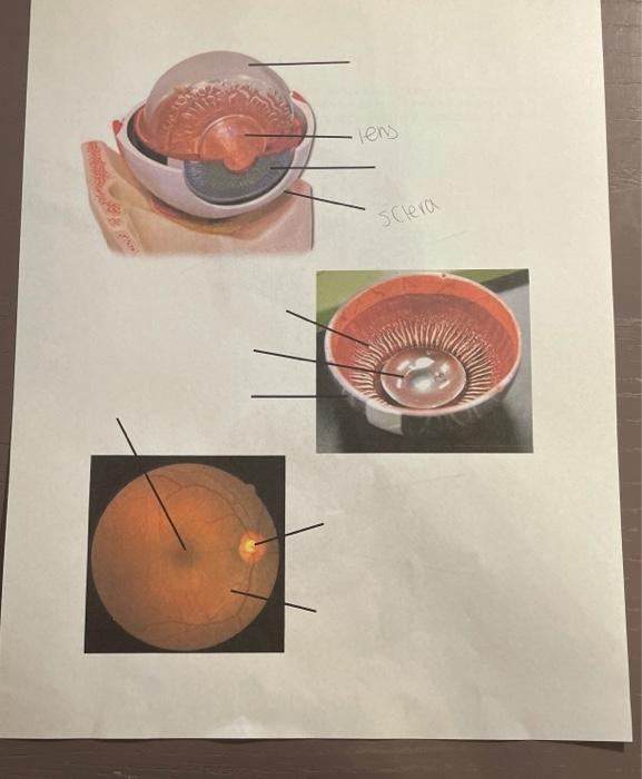 Solved lens sclera | Chegg.com