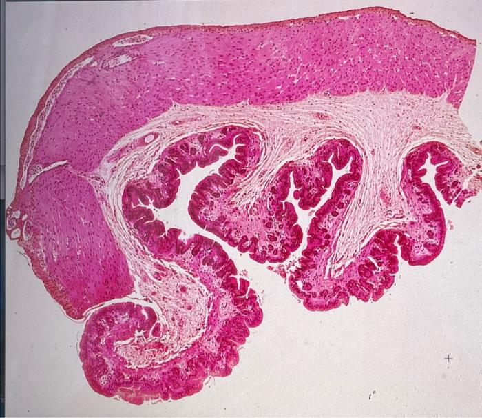 Solved What organ is this | Chegg.com