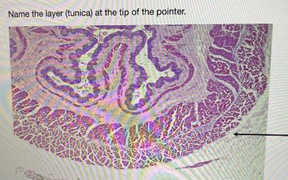 Solved Name the cells at the tip of the pointer. What is | Chegg.com