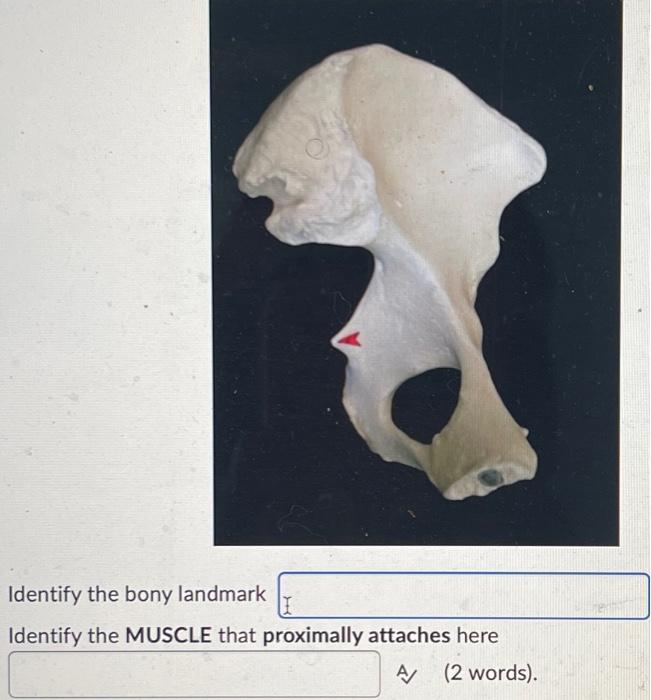 Solved Identify the bony landmark Identify the MUSCLE that | Chegg.com