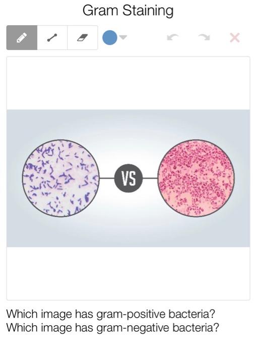 Solved Simple Stain You perform a wet mount and observe your | Chegg.com