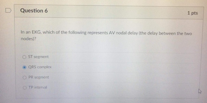 Solved In an EKG, P Wave represents .... AV nodal delay O | Chegg.com