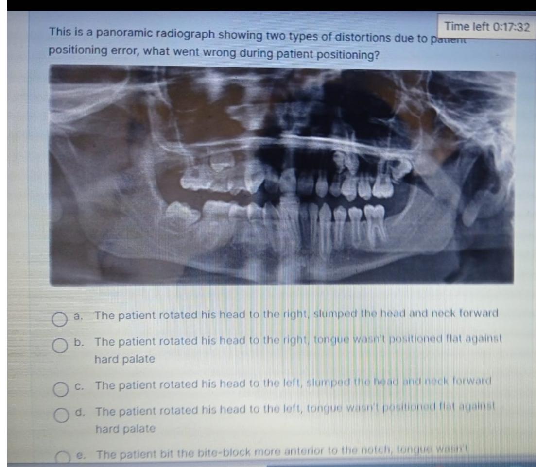Solved Time left 0:17:32This is a panoramic radiograph | Chegg.com