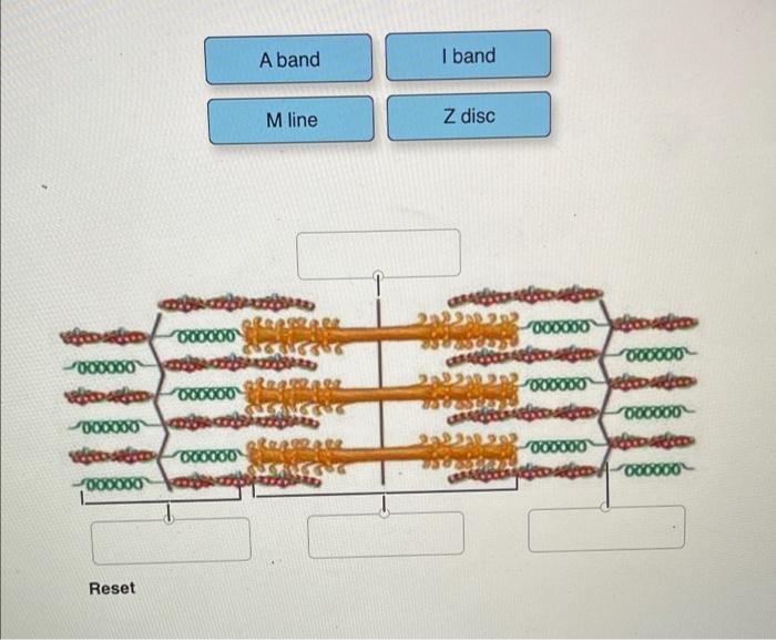 Solved A band I band M line Z disc CCCC జయ మాట 7000000 | Chegg.com