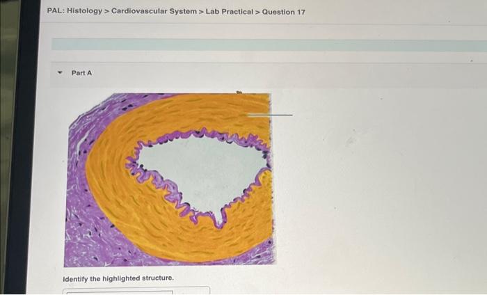 Solved PAL: Histology > Cardiovascular System > Lab | Chegg.com