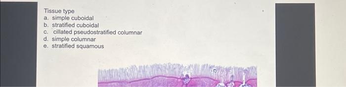 Solved Tissue type a. simple cuboidal b. stratified cuboidal | Chegg.com