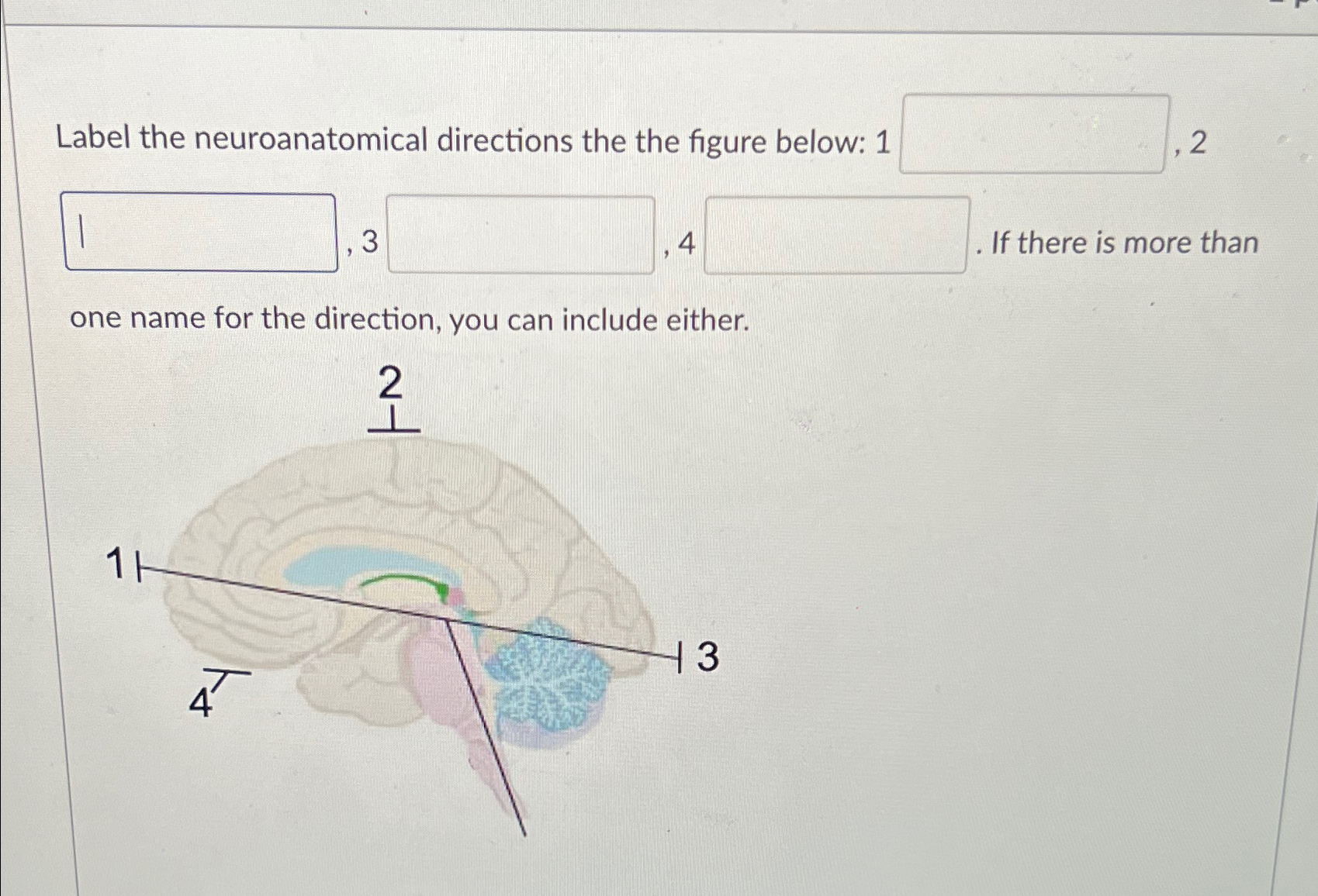 Solved Label the neuroanatomical directions the the figure | Chegg.com