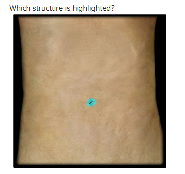 Solved Which structure is highlighted in blue? | Chegg.com