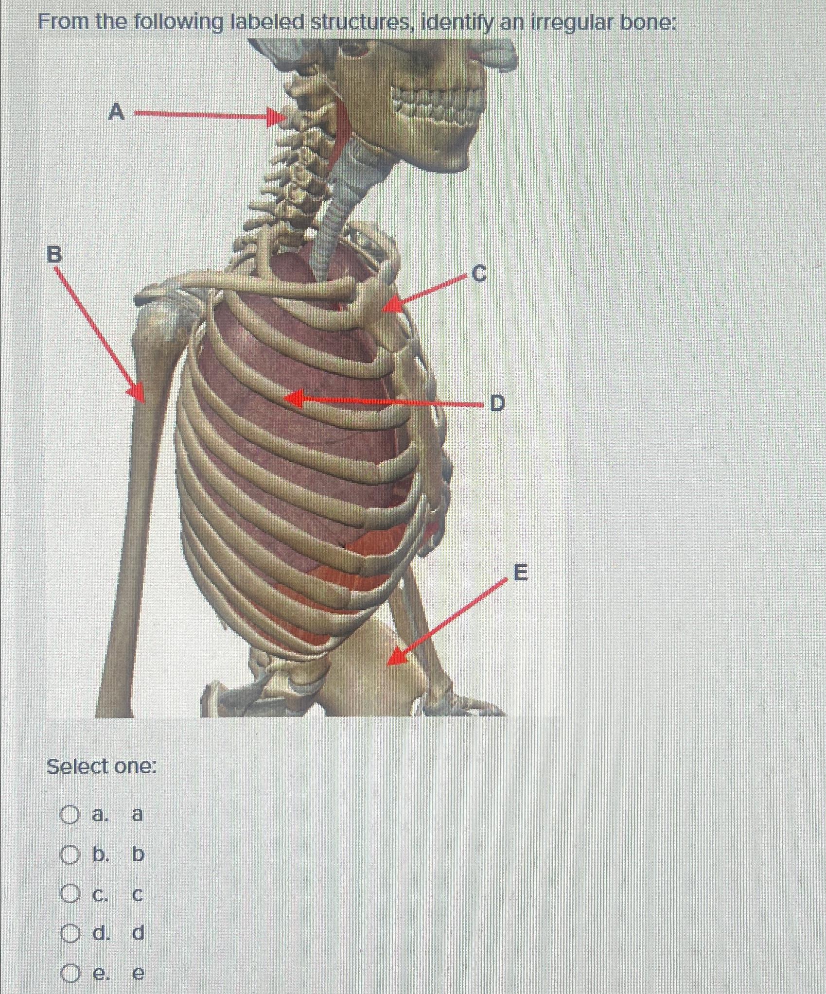 Solved From the following labeled structures, identify an | Chegg.com