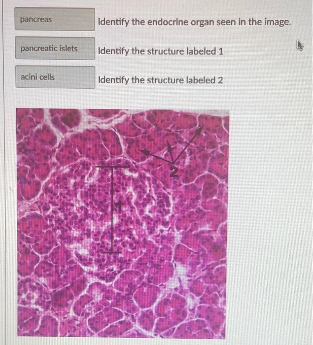 Solved pancreas Identify the endocrine organ seen in the | Chegg.com