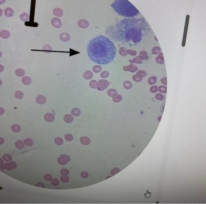 Solved identifybthe cells from a peritoneal fluid | Chegg.com