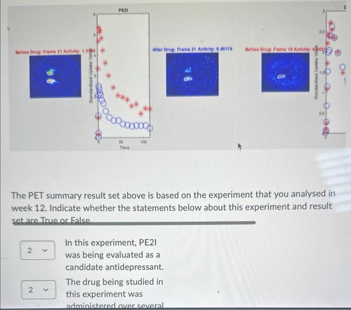Solved The PET summary result set above is based on the | Chegg.com