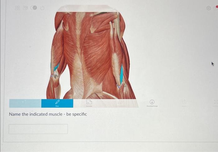 Solved Name one insertion of the indicated muscle Aside | Chegg.com