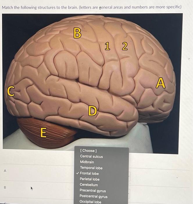 Solved Match the following structures to the brain. (letters | Chegg.com