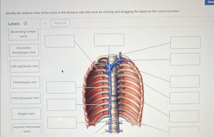 Solved identify the anterior view of the veins in the | Chegg.com