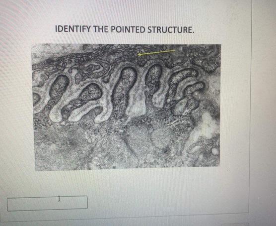 Solved IDENTIFY THE POINTED STRUCTURE. | Chegg.com