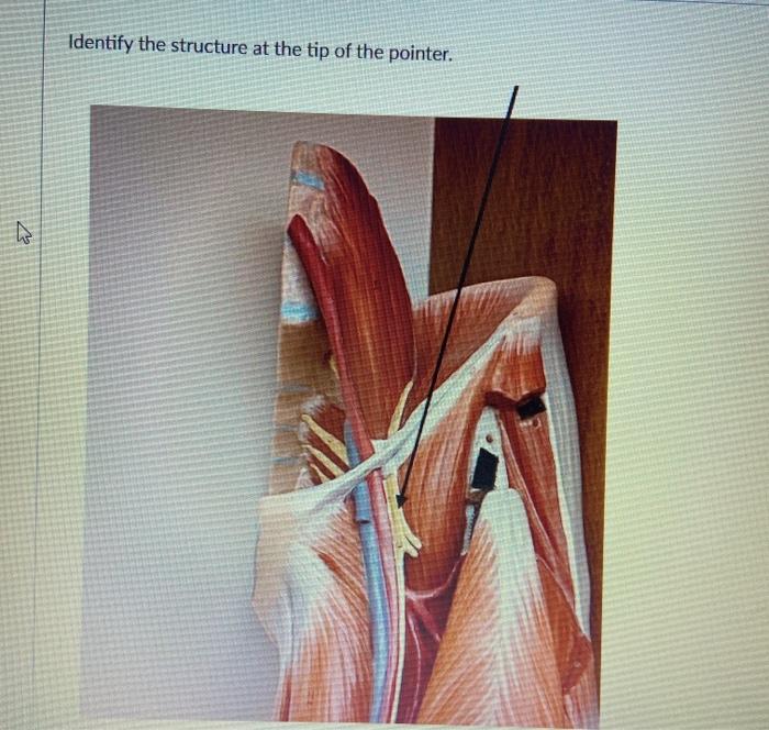 Solved Identify the structure at the tip of the pointer. 7 | Chegg.com