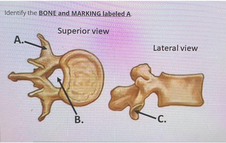 Solved Identify the BONE and MARKING labeled A. | Chegg.com