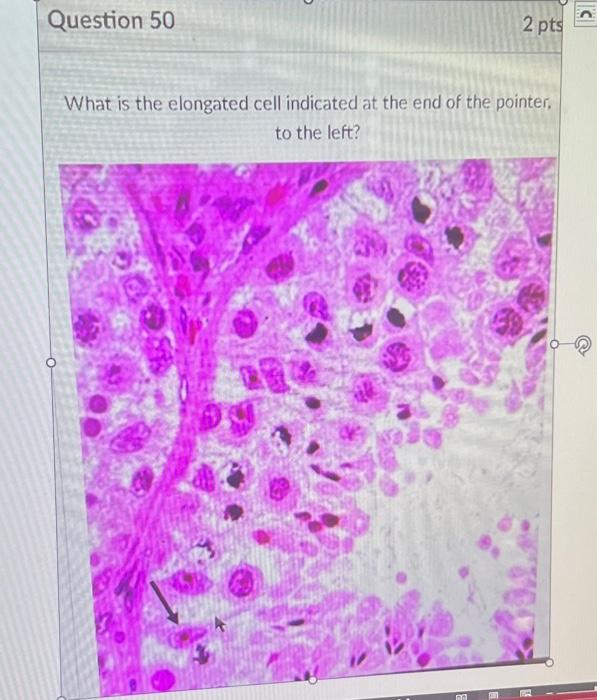 Solved What is the elongated cell indicated at the end of | Chegg.com