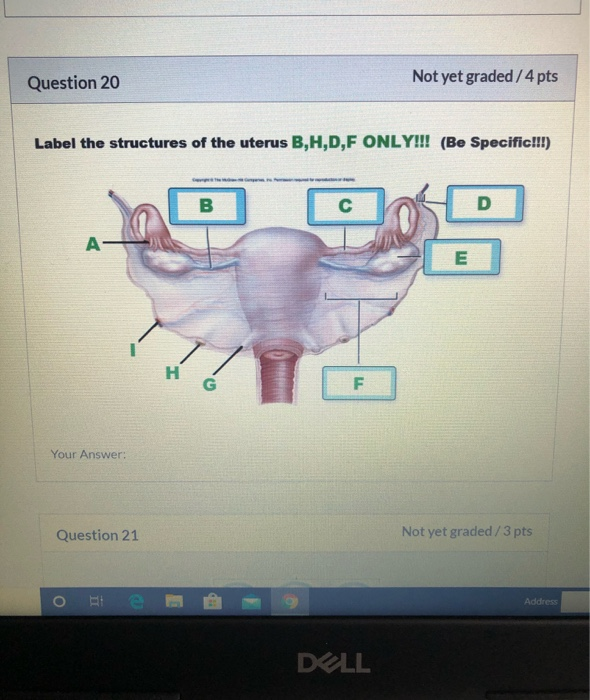 Solved Question 20 Not yet graded/4 pts Label the structures | Chegg.com