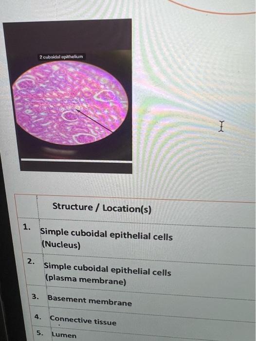 Structure / Location(s) 1. Air Sacs 2. Squamous | Chegg.com