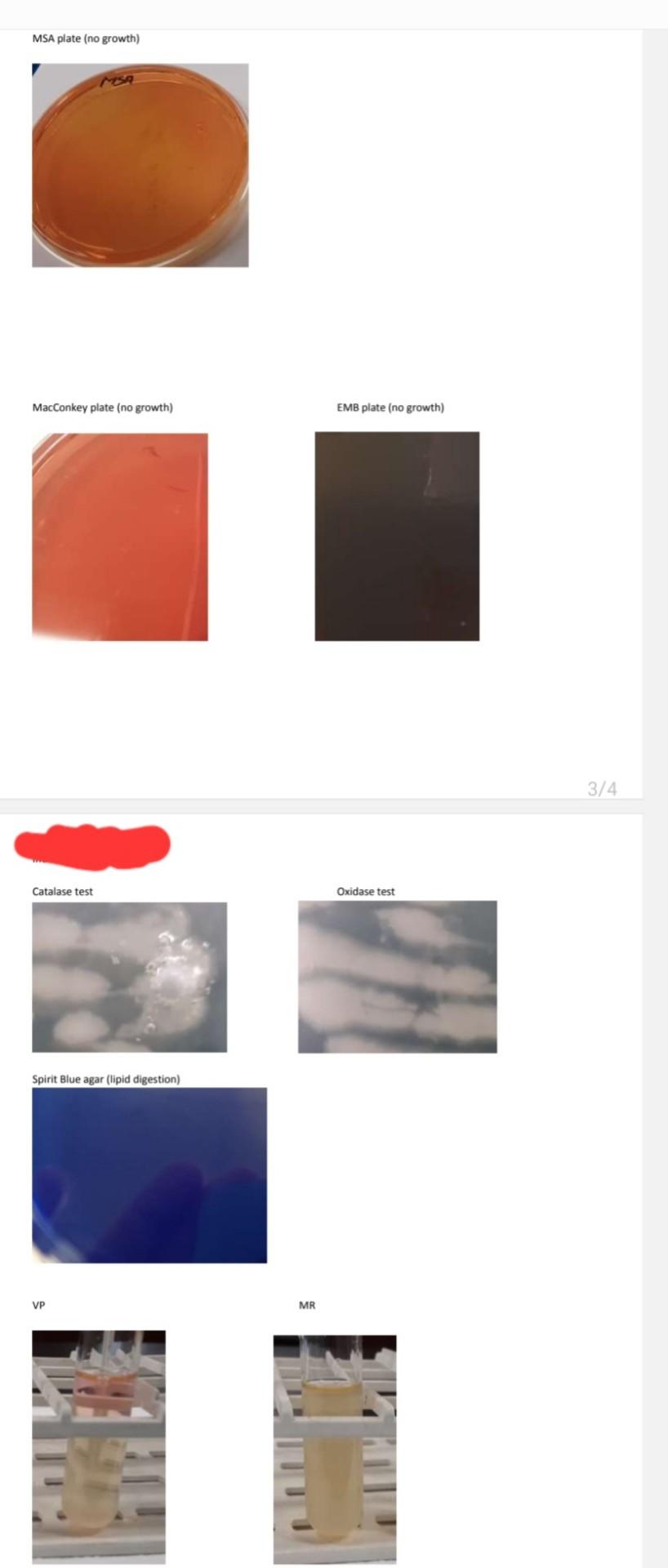 Solved MSA plate (no growth) MacConkey plate (no growth) EMB | Chegg.com