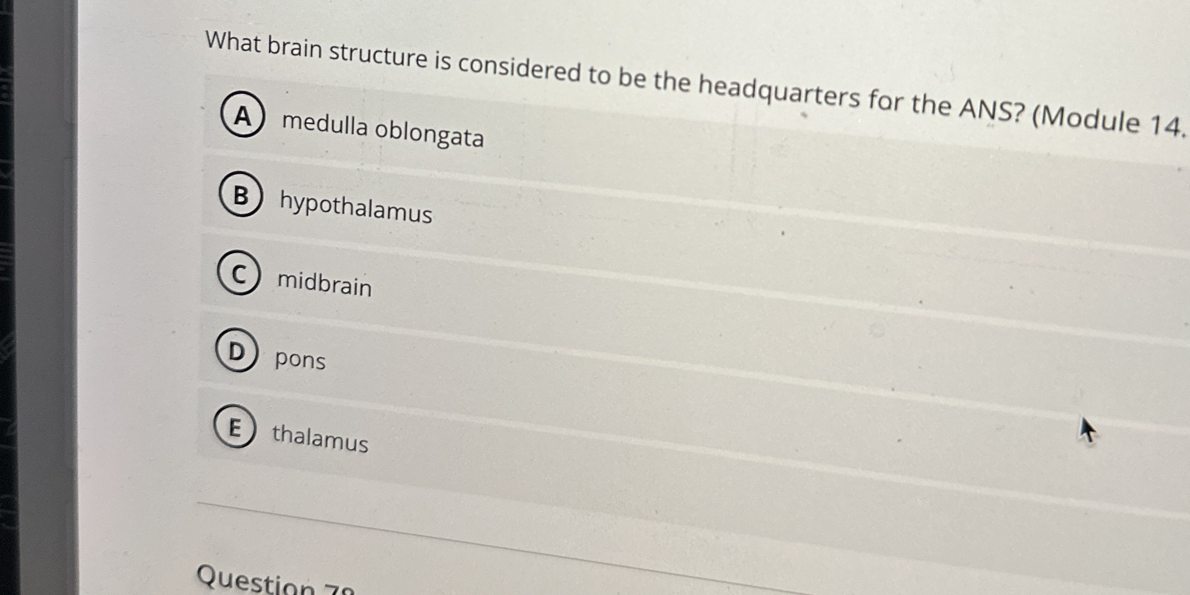 Solved What brain structure is considered to be the | Chegg.com