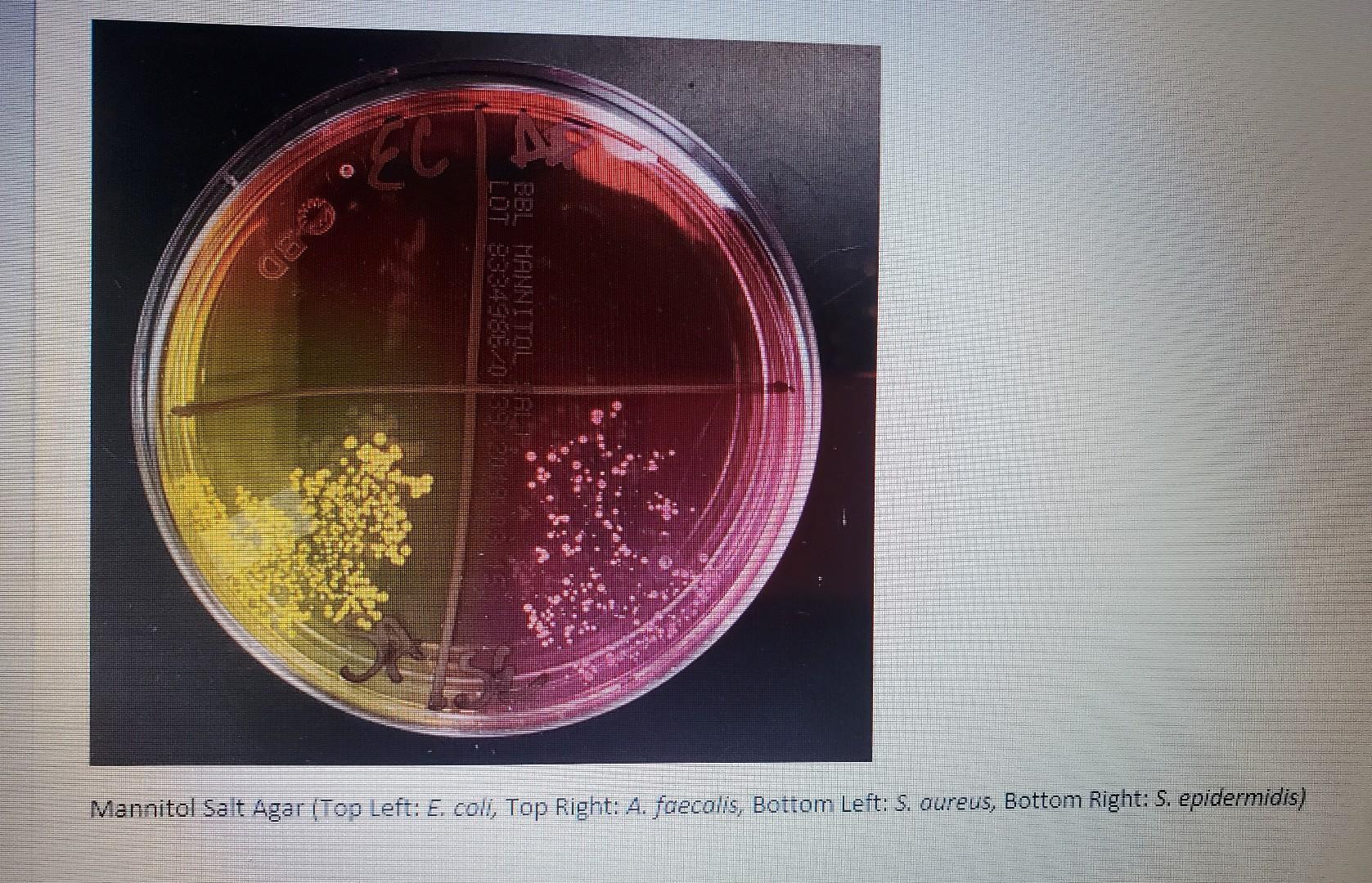 Solved RESULTS Nutrient Agar Mannitol Salt Agar Organism EMB | Chegg.com