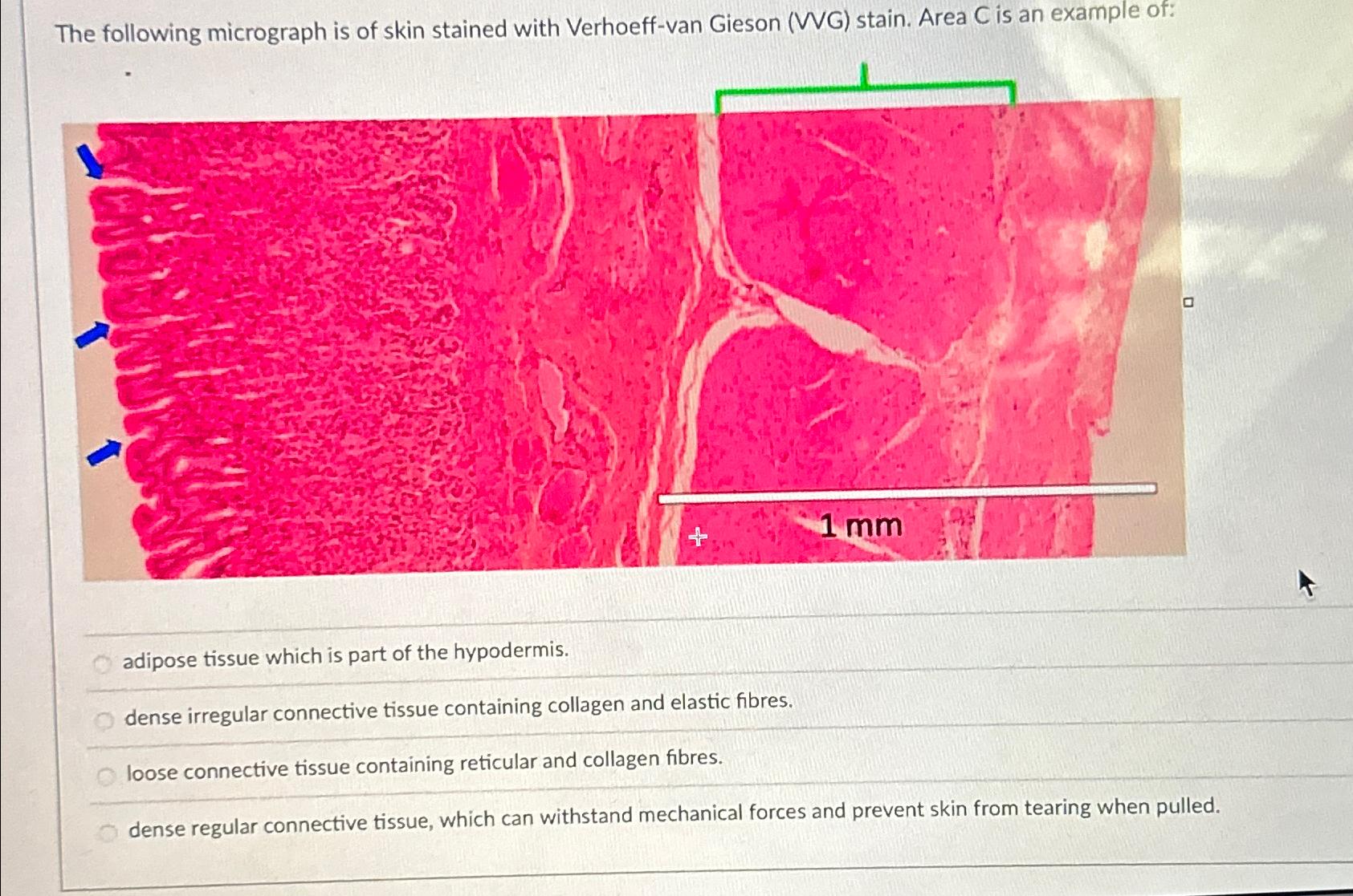 Solved The following micrograph is of skin stained with | Chegg.com