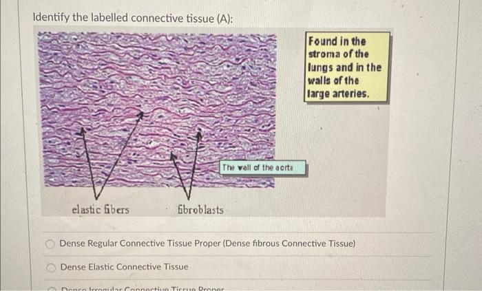 Solved Found in th stroma of th lungs and in walls of the | Chegg.com