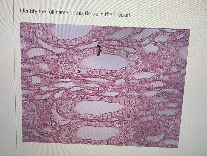 Solved Identify the full name of this tissue in the bracket. | Chegg.com