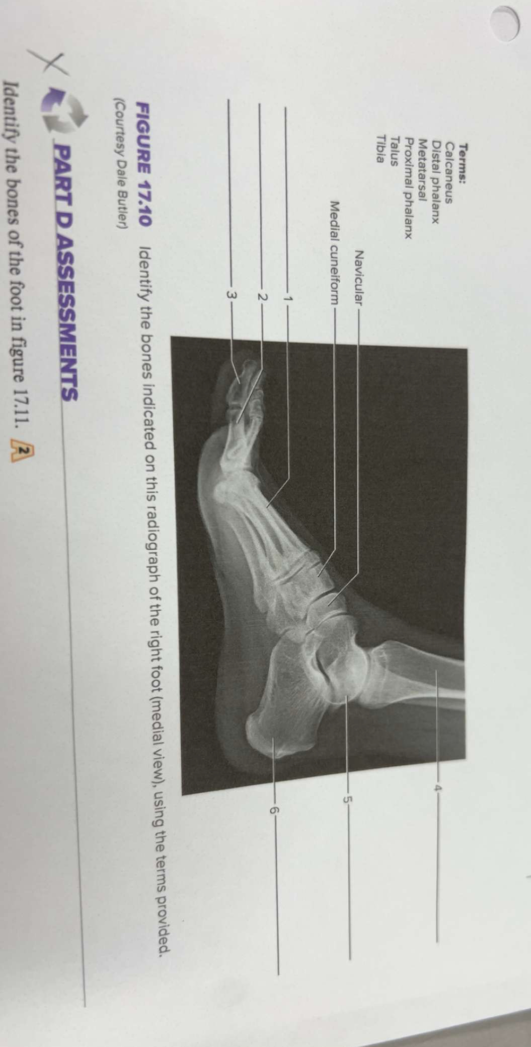 Solved FIGURE 17.10 ﻿Identify the bones indicated on this | Chegg.com