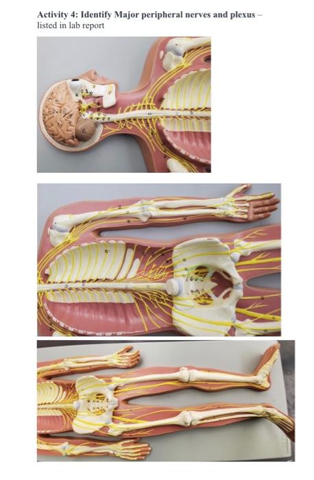 Solved Activity 4: Identify Major peripheral nerves and | Chegg.com