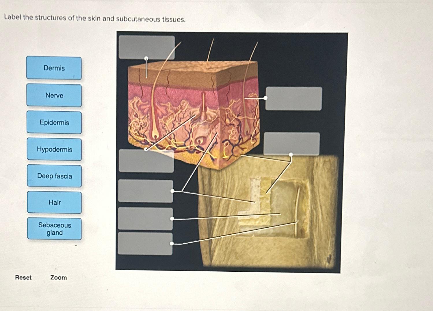 Solved Label the structures of the skin and subcutaneous | Chegg.com