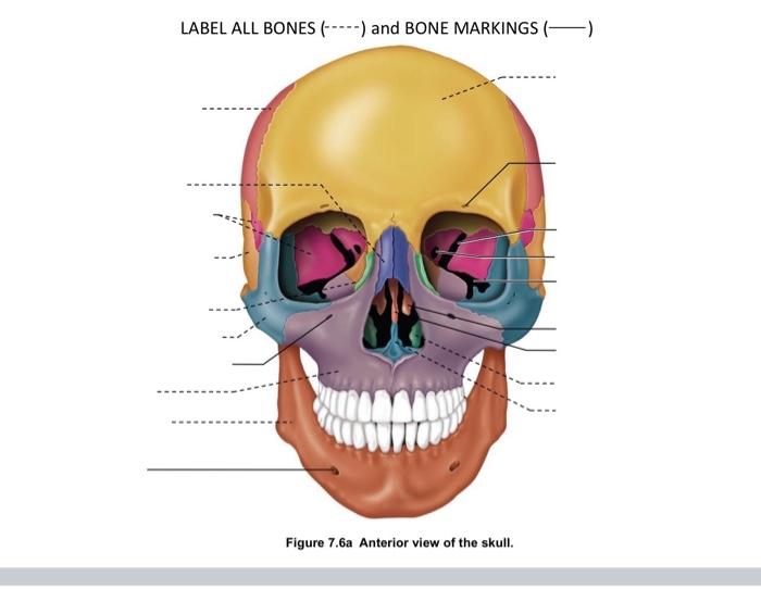 Solved LABEL ALL BONES (−−−) and BONE MARKINGS (−) | Chegg.com