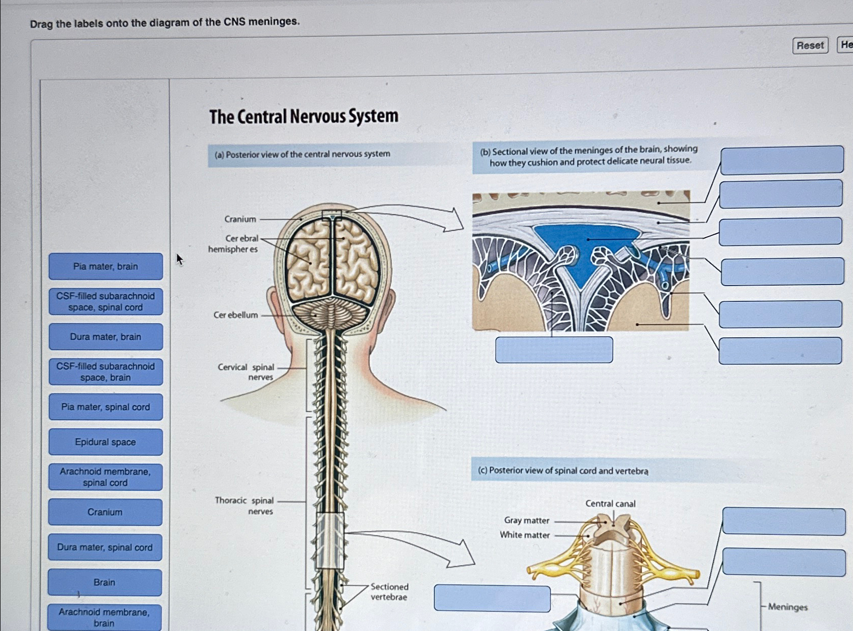 Solved drag the lables onto the diagram of the CNS meninges | Chegg.com