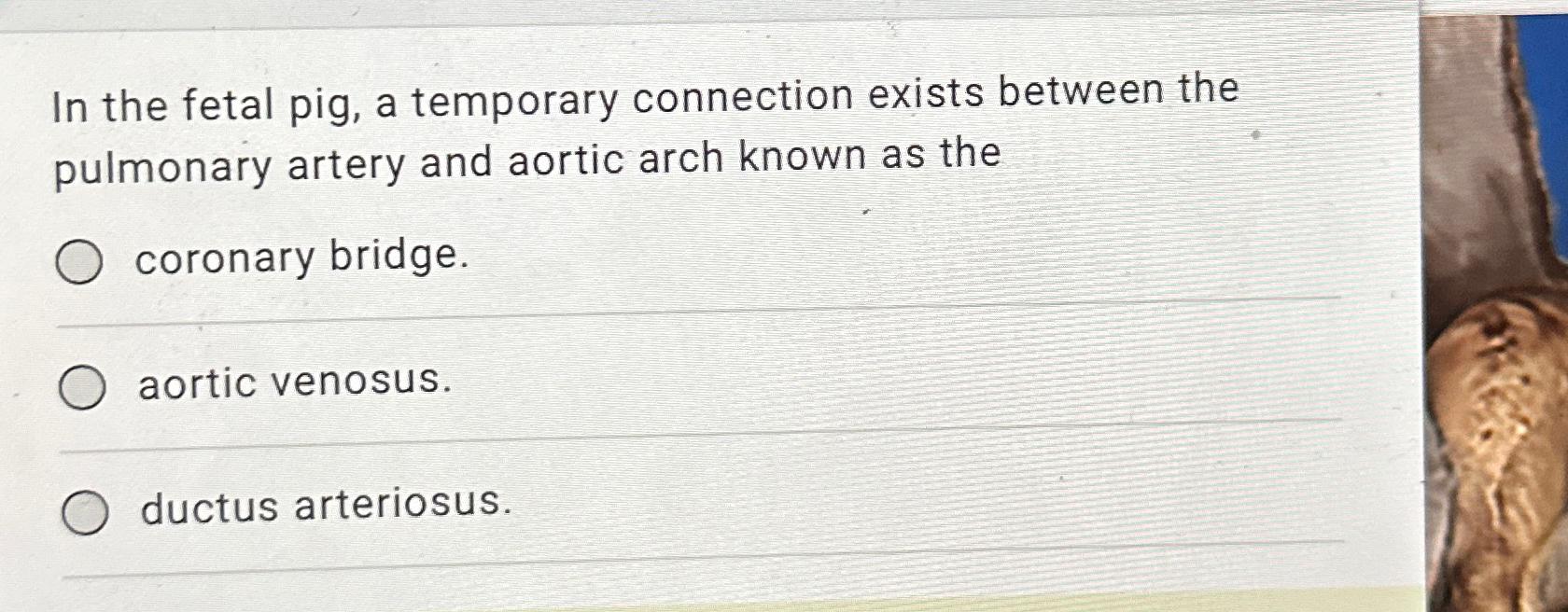 Solved In the fetal pig, a temporary connection exists | Chegg.com