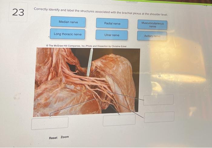 Solved Correctly identify and label the structures | Chegg.com